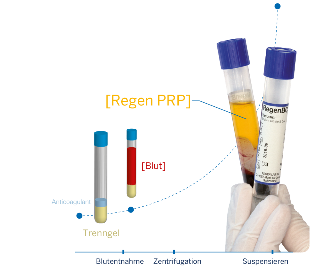 Home - RegenPRP bei Arthrose - Regenlab