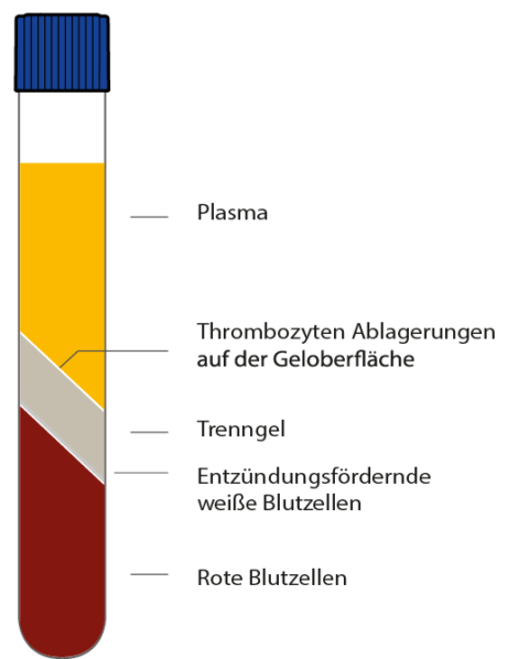 Regen BCT - RegenLab GmbH